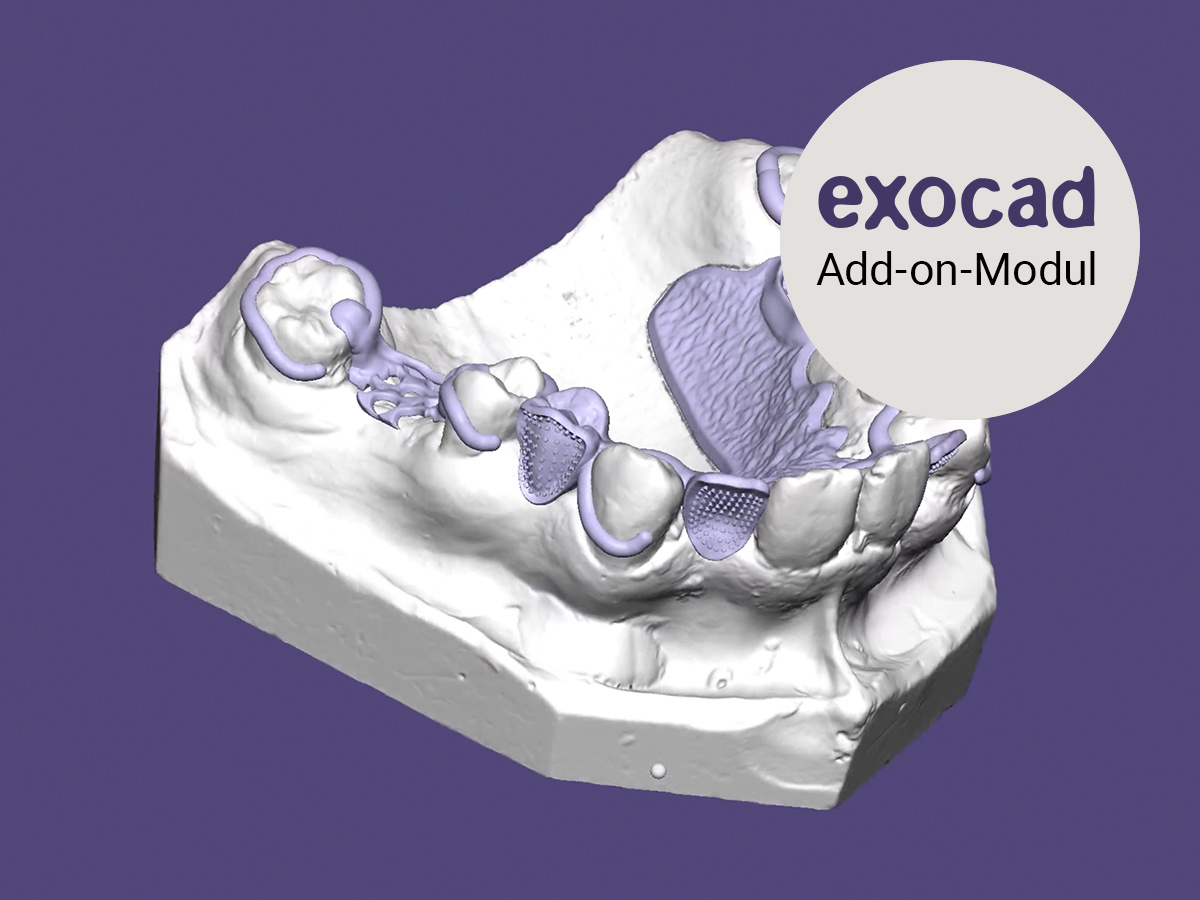 exocad PartialCAD Module | Gold Quadrat Dental