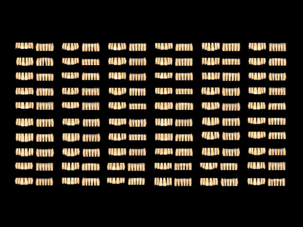 exocad Tooth Library ZRS | Gold Quadrat Dental