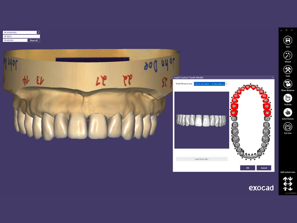 exocad Tooth Library ZRS | Gold Quadrat Dental